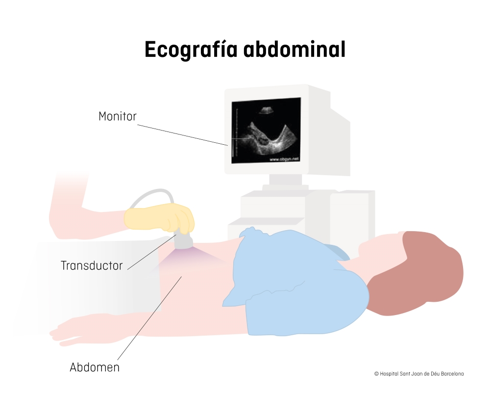 Ecografía obstétrica y ginecológica | Escola de Salut SJD