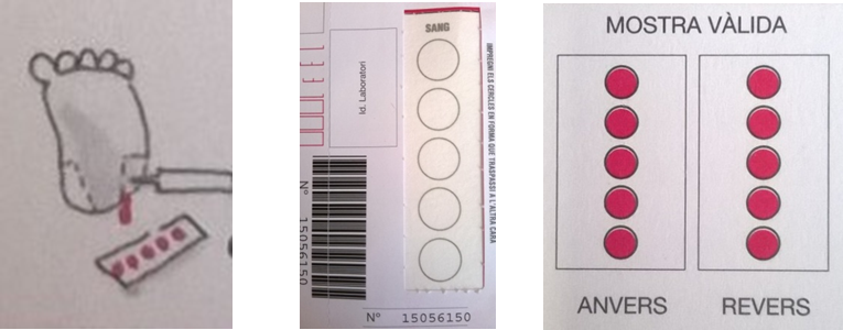 En qué consiste el cribado metabólico neonatal (prueba del talón ...